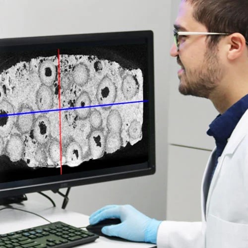 X-ray Computed Tomography