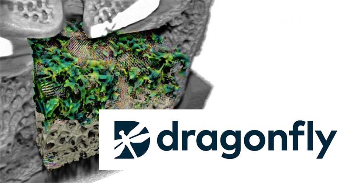 CT Analysis Software Product Review: Dragonfly by ORS