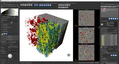 Best CT Analysis Software