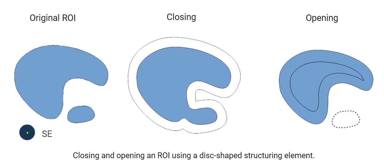 How to Refine CT Image Segmentation