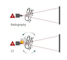 What is the difference between CT and radiography?