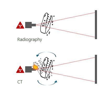 What is the difference between CT and radiography?