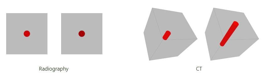 What is the difference between CT and radiography?