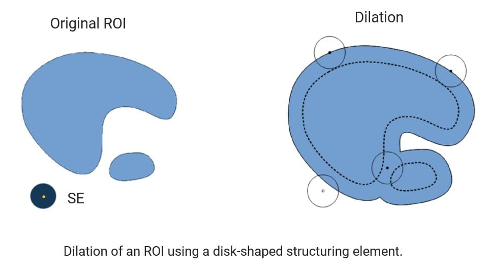 How to Refine CT Image Segmentation