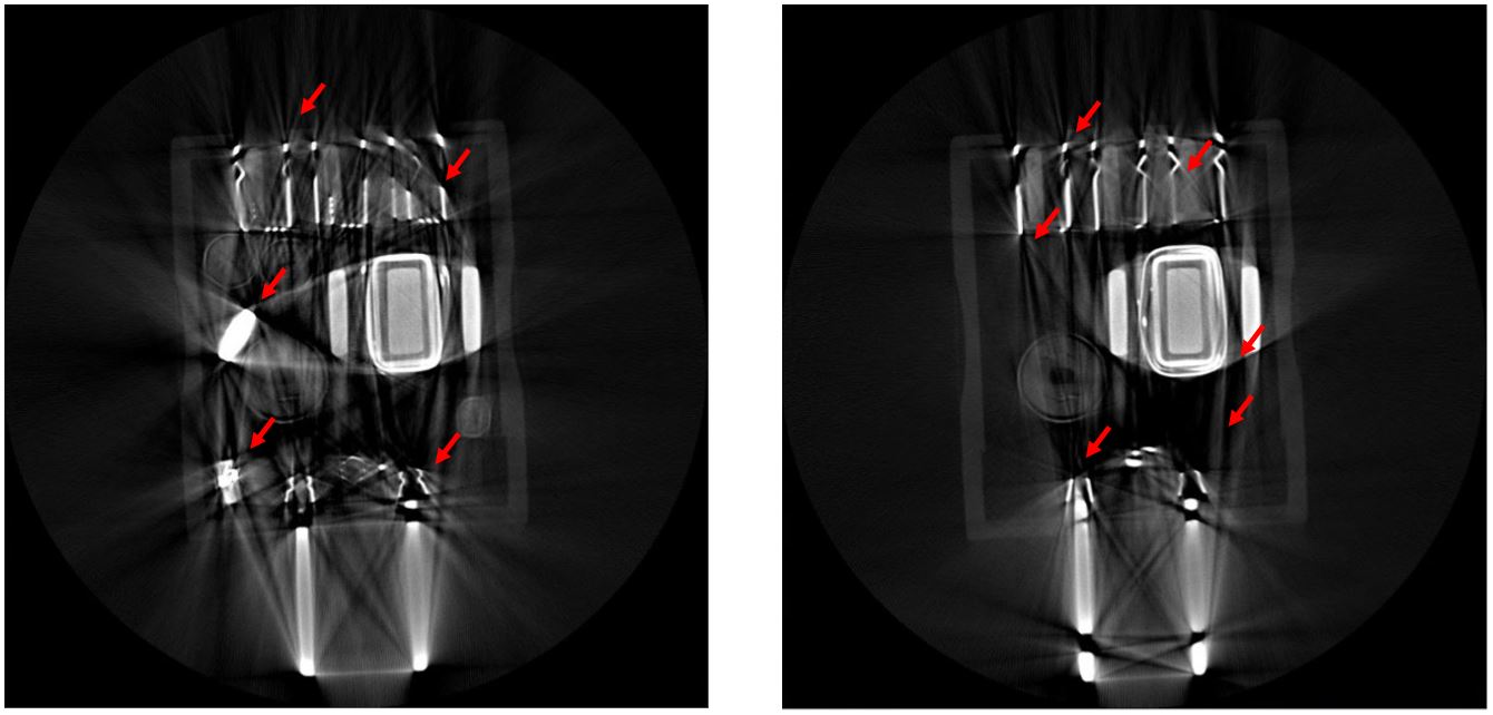 How to Recognize CT Artifacts and Minimize Them During Data Collection