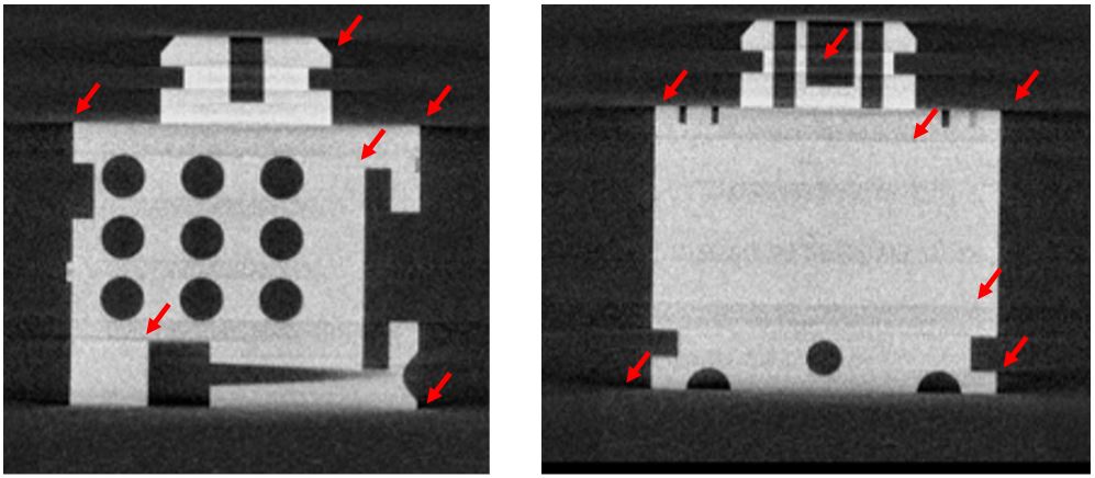 How to Recognize CT Artifacts and Minimize Them During Data Collection