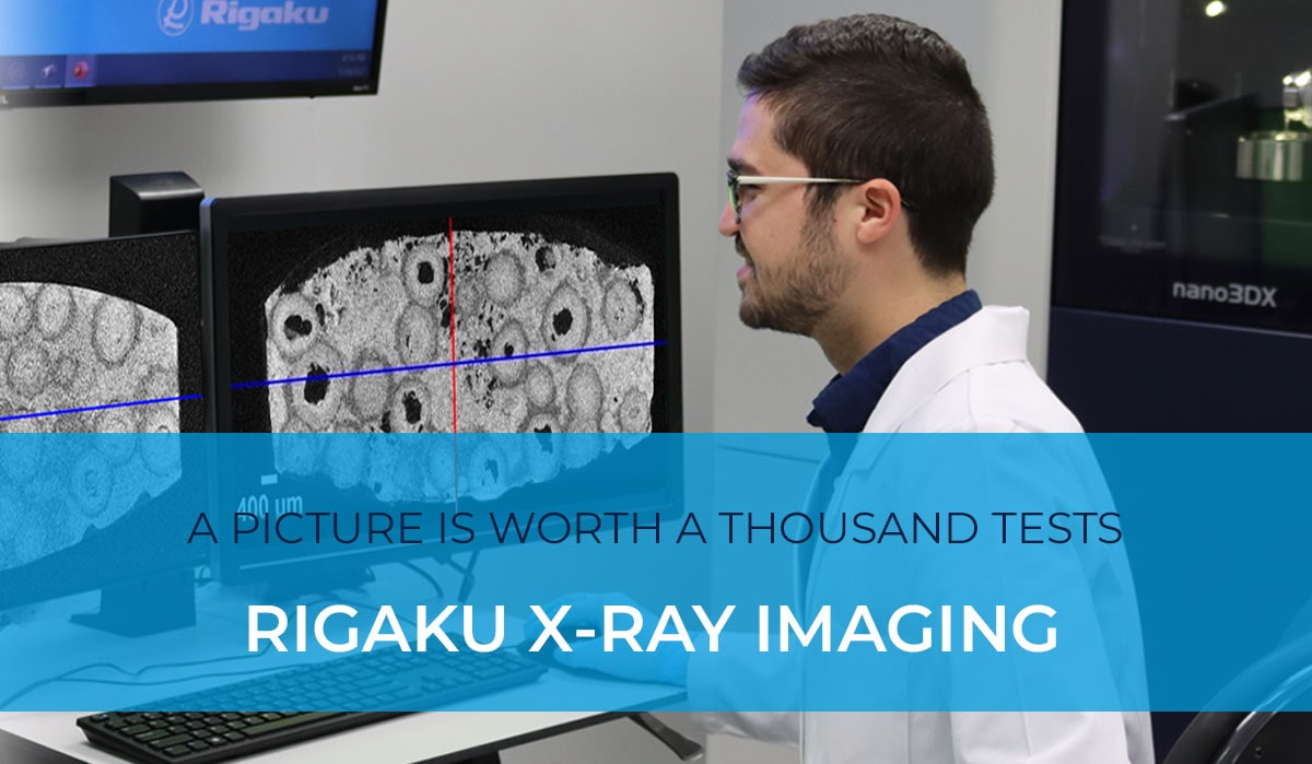 X-ray Computed Tomography